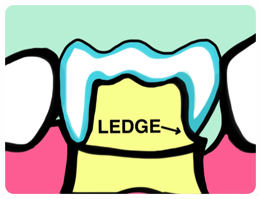 LOGICAL DENTISTRY - Crowns